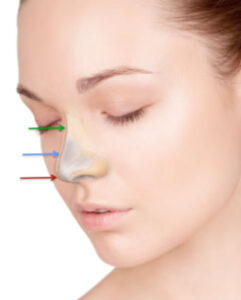 Anatomy of the Nose | Nose Reconstruction Clinic